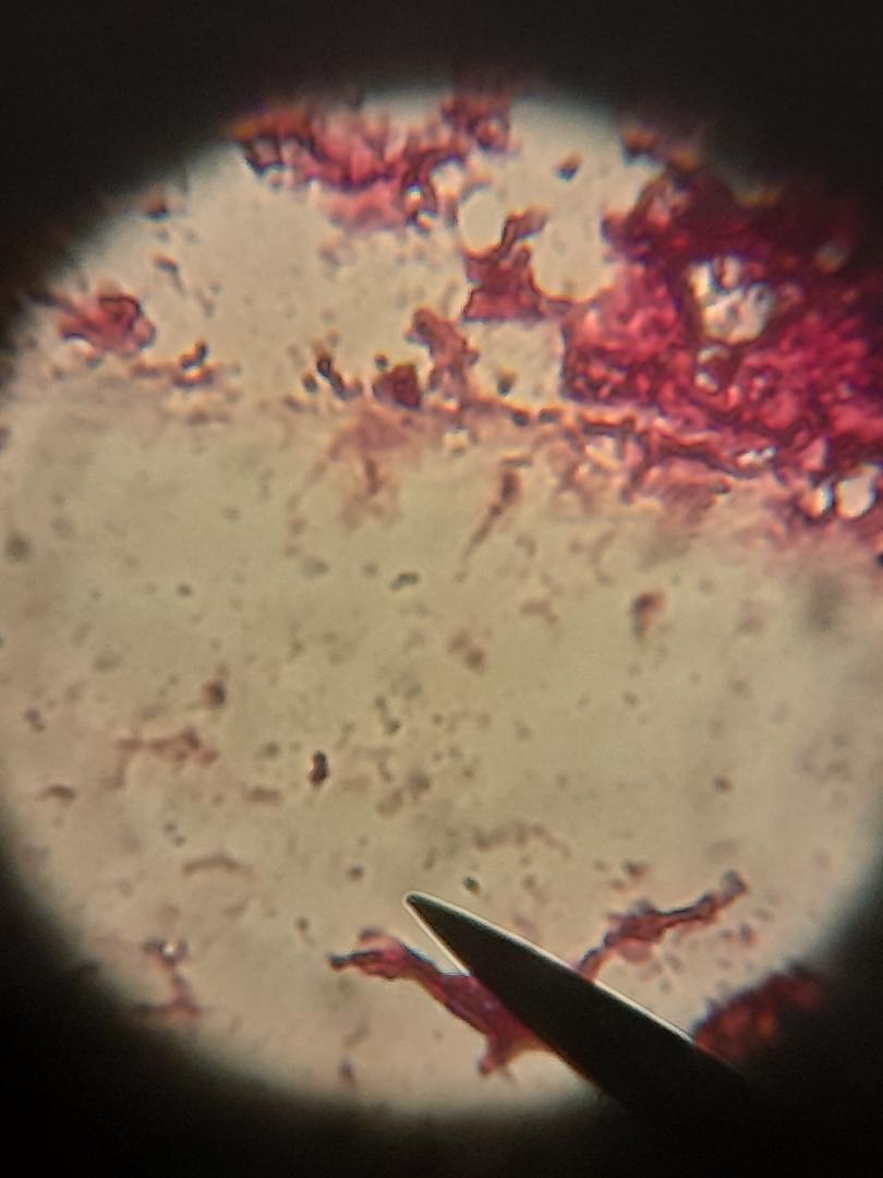 Microbiote de la Drosophile – SVT Labs