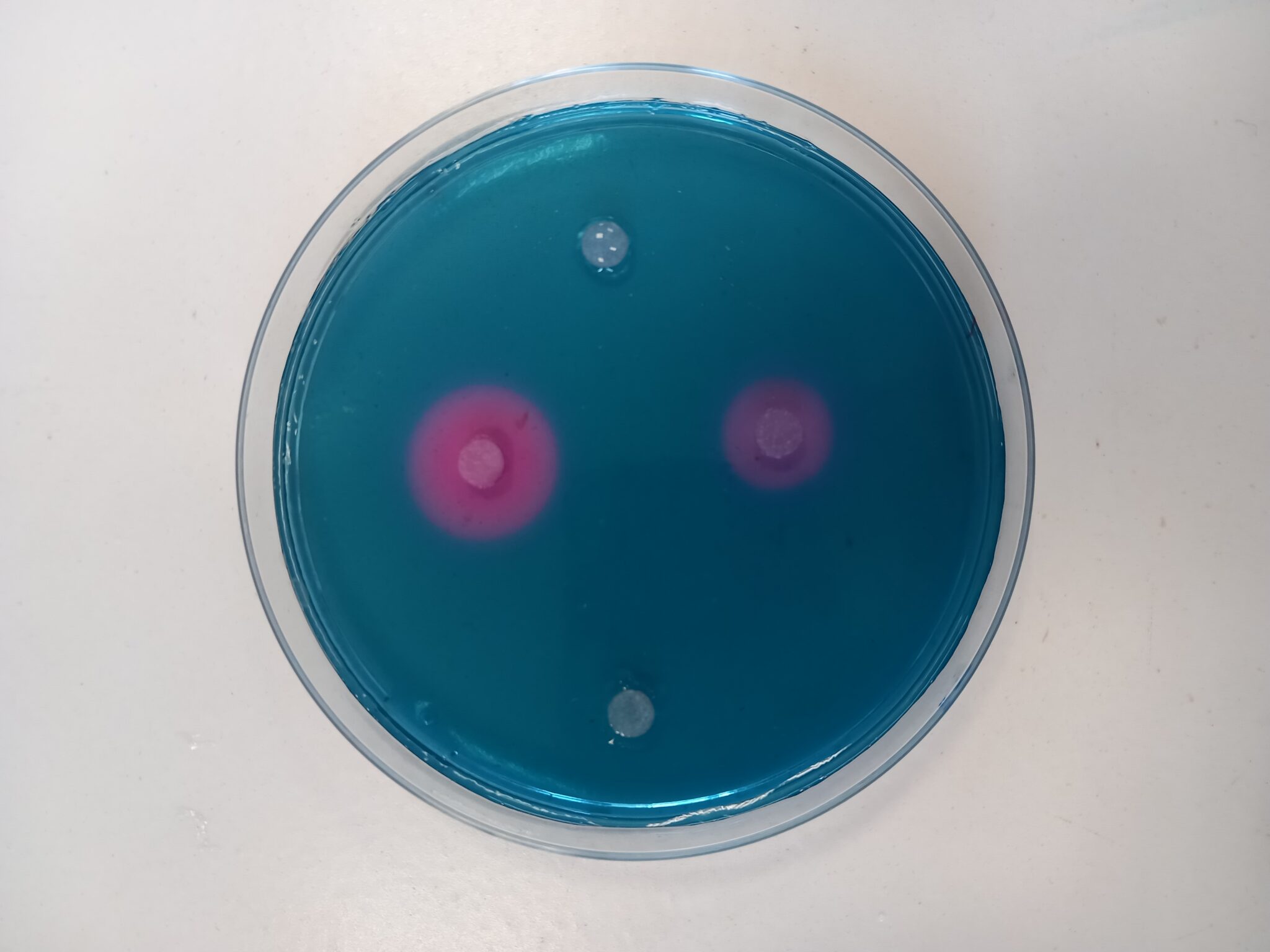 Antibiogramme de substitution – SVT Labs